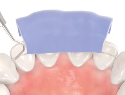 memotain | uportho.com 2025