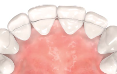 memotain | uportho.com 2025